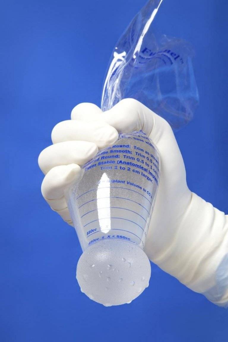 Breast Augmentation Using The Keller Funnel