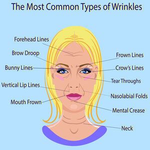 Common Types of Facial Wrinkles (Rhytides) - Westlake Dermatology