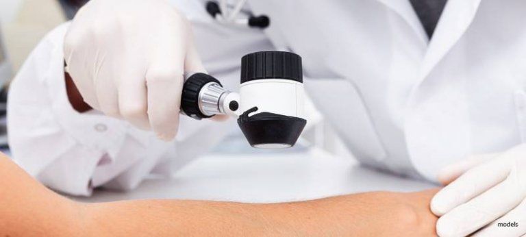 Everything You Need to Know About Mole Removal - Westlake Dermatology
