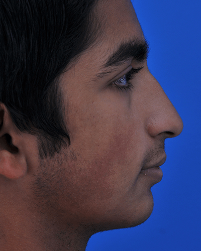 Male Nose Side Profile