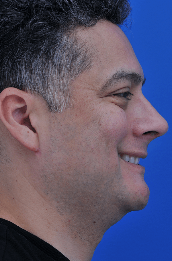 Austin Chin Augmentation Specialists - Surgical & Non-Surgical